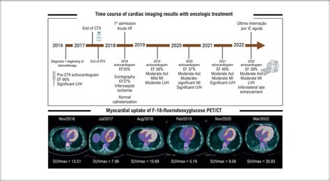 Progression Of Myocardial 18f Fdg Uptake In A Patient With Cardiotoxicity Abc Cardiol
