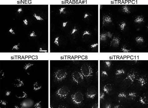 Effect Of Trapp Complex Component Depletion On Golgi Morphology Scale