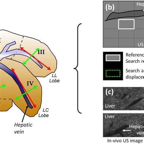 Us Image Based Dynamic Fusion Modeling Principle A Position Of The