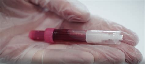 Piston Detection New Atras Feature Tando Labsystems