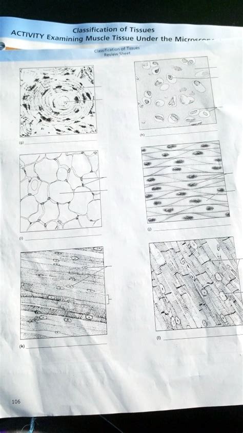 Label The Tissue Type Illustrated Here And Identify All Structures