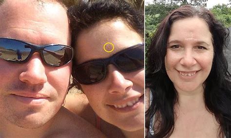 Mother Who Dismissed A Mark As A Scratch Caused By A Hairbrush