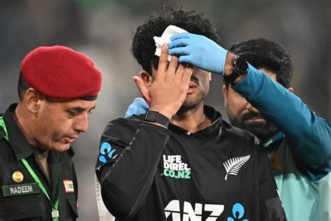 سہ ملکی سیریز نیوزی لینڈ کے رچن روندرا کو پہلے ہی میچ میں ہیڈ انجری