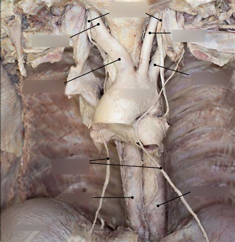Diagram Of Aorta And Its Branches Labelling Quizlet