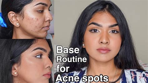 Flawless Base Routine For Acne Prone Skin Acne Pigmentation Youtube