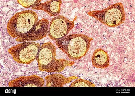 Brain Nerve Cells Transmission Electron Micrograph Tem Of A Section