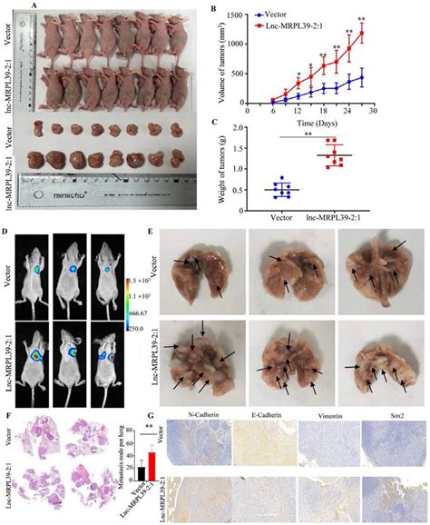 Upregulated Long Non Coding RNA Lnc MRPL39 2 1 Induces The Growth And Invasion Of Nasopharyngeal