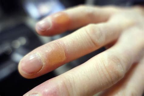 Us Is So Cold People Could Get Frostbite If Theyre Outside For Just Minutes