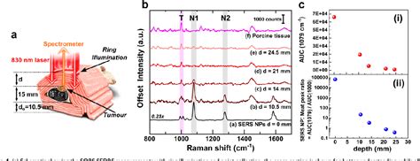 Figure 4 From Surface Enhanced Deep Raman Detection Of Cancer Tumour