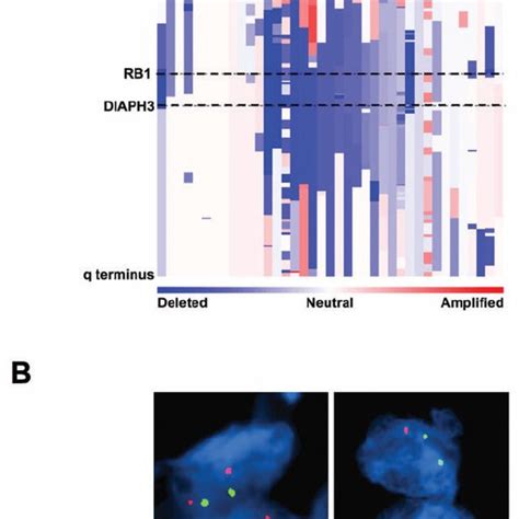 Pdf Oncosome Formation In Prostate Cancer Association With A Region