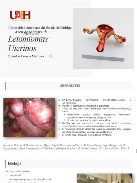 Leiomiomas Uterinos Gyo Pdf