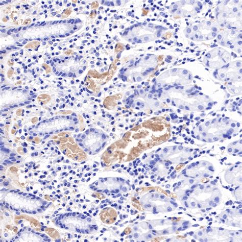 Rabbit Anti Hemoglobin Recombinant Monoclonal Antibody 193 71 Absin 优宁维 Univ 商城