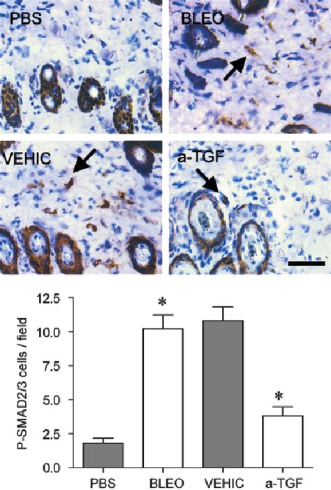 Immunohistochemical Detection Of Connective Tissue Growth Factor Ctgf