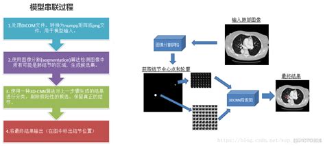 基于深度学习的ct图像肺结节自动检测技术（行业及技术分析） 51cto博客 ct自动肺结节分析技术