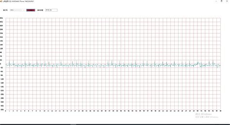 Stm32实现心电监测 原理图单片机程序c上位机程序心电检测上位机 Csdn博客