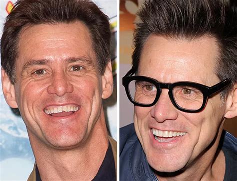 Jim Carrey Dazzling Smile Transformation