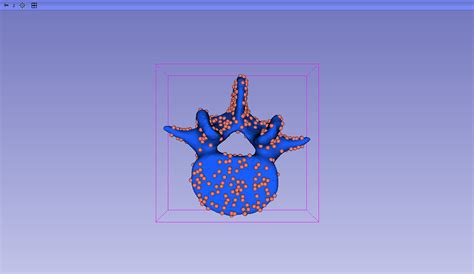 How To Reconstruct The Whole Vertebrae Using The Reconstructed Volume