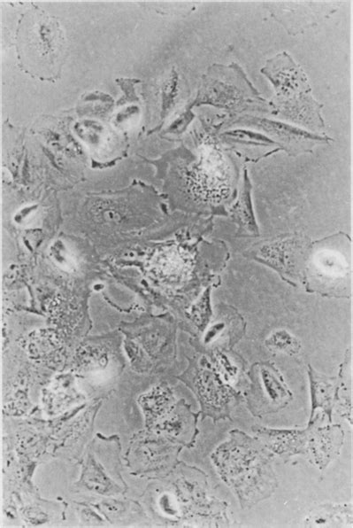 Photomicrograph Of Isolated Human Osteoblast Like Cells Human