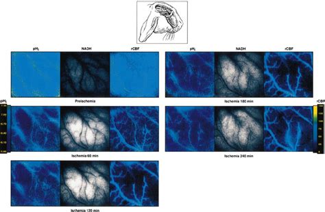 This Composite Photograph Is An Example Of A Hyperglycemianormoxia