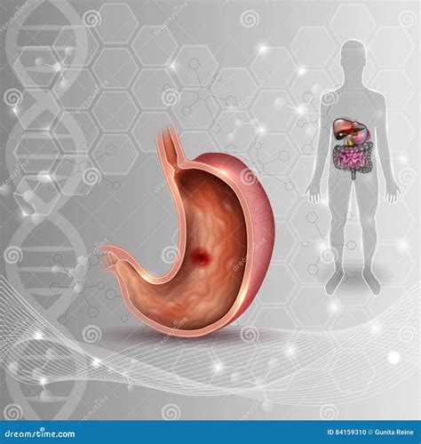 Stomach Ulcer Interanl Organs Anatomy Colorful Drawing Vector
