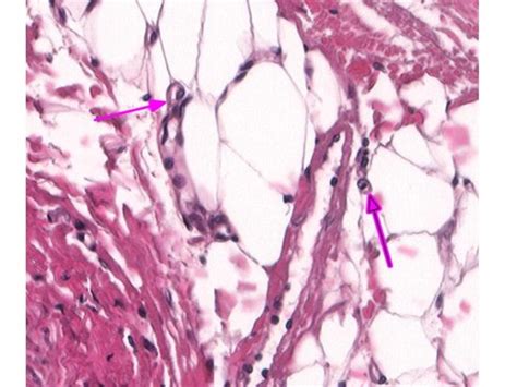Histo Cardio Flashcards Quizlet