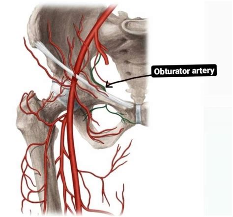 Obturator Artery Femoral Head