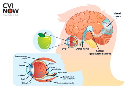 The Visual Pathway From The Eye To The Brain Perkins School For The Blind