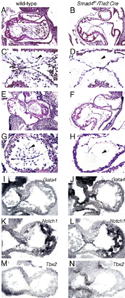Endocardial Loss Of Smad4 Causes Acellular Endocardial Cushions
