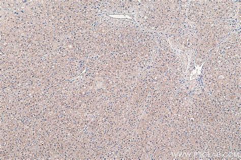 Ihceasy Fkbp4fkbp52 Ready To Use Ihc Kit Khc0417 Proteintech 武汉三鹰生物技术有限公司