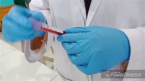 Pemeriksaan Hitung Jumlah Eritrosit YouTube