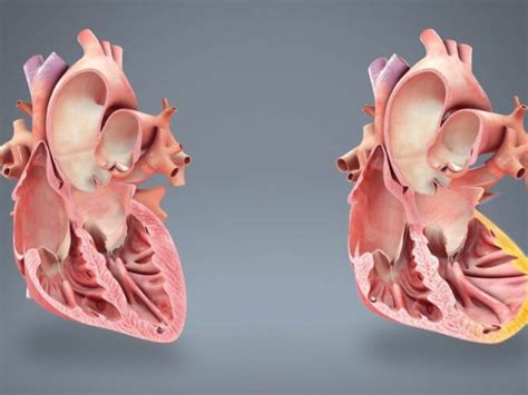 6 Nejčastějších Faktorů Které Vám Způsobují Srdeční Arytmii