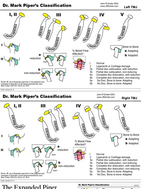 Piper Classification Card Pdf Musculoskeletal System Joints