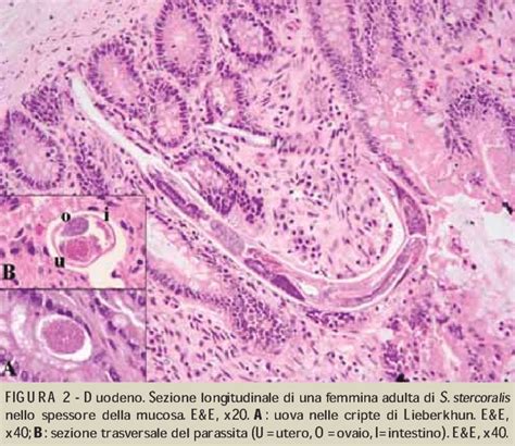 Ntestine Duodenum Longitudinal Section Of An Adult Female Of S