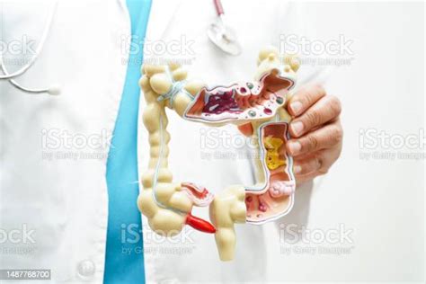 장 병원에서 연구 진단 및 치료를 위한 해부학 모델을 들고 있는 의사 건강 진단에 대한 스톡 사진 및 기타 이미지 건강 진단
