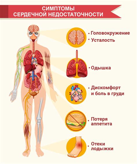 Сердечная недостаточность - симптомы, что это такое, как понять что она ...