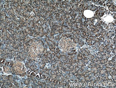 4ebp1 Mouse Anti Human Mouse Rat Clone 2c3f3 Proteintech 20 μl