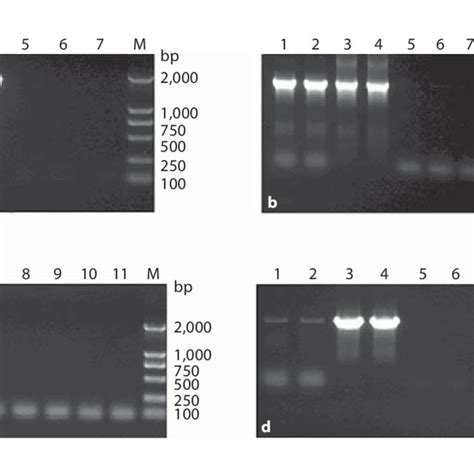 The Results Of Purified Armored Rna By Cscl Gradient Centrifugation 1 Download Scientific
