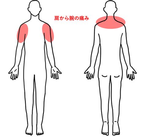 大野城整体肩から腕にかけての痛み
