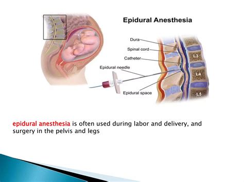 Local Anaesthetics Ppt