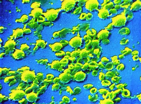 False Colour Sem Of Mycoplasma Sp By Cnri Science Photo Library