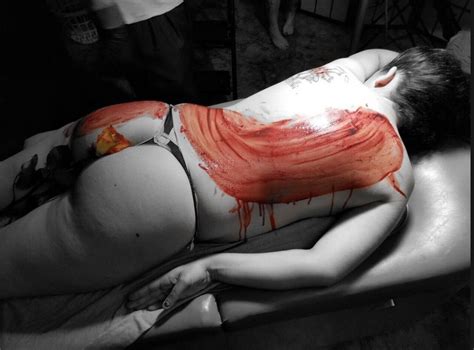 I Was A Bloody Mess After Needle Removal Tried A Gauge Needle To See How Id Handle A Needle