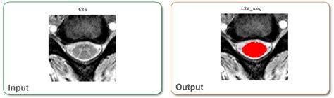 Spinalcordtoolbox Documentation Source User Section Tutorials Gray