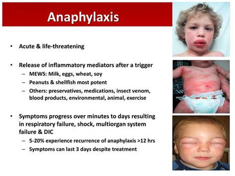 Ppt Pediatric Respiratory Emergencies Powerpoint Presentation Id