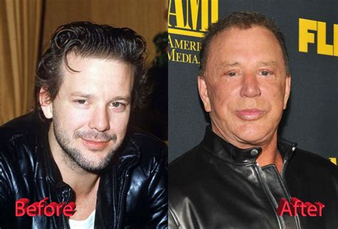 Mickey Rourke Plastische Chirurgie Voor En Na Mickey Rourkes Plastic