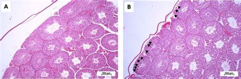 Representative Photomicrographs Showing Histopathology Hande Of The