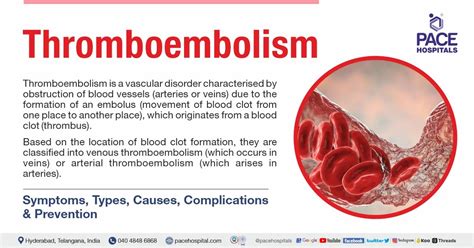Effectiveness Of Thrombolytic Therapy In Acute Embolic