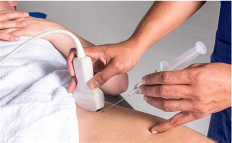 Hip Joint Injections Everything You Need To Know Sport Doctor London