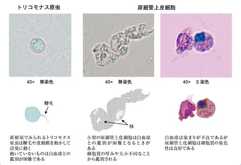 尿沈渣検査