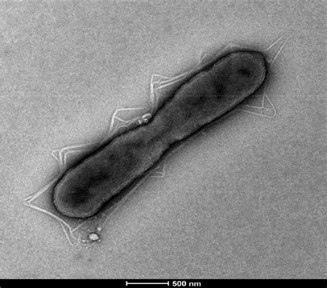 Transmission Electron Microscopy Of Chryseobacterium Senegalense Strain