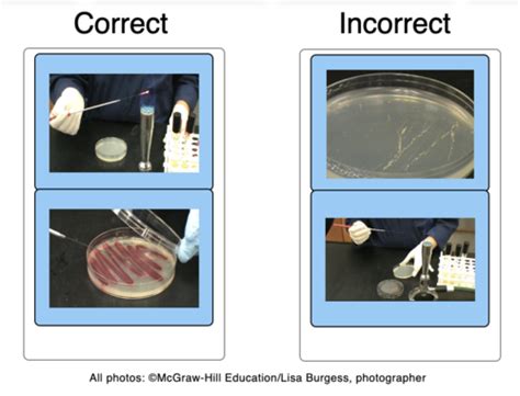 Microbiology Lab Module 2 Lab Report Flashcards Quizlet